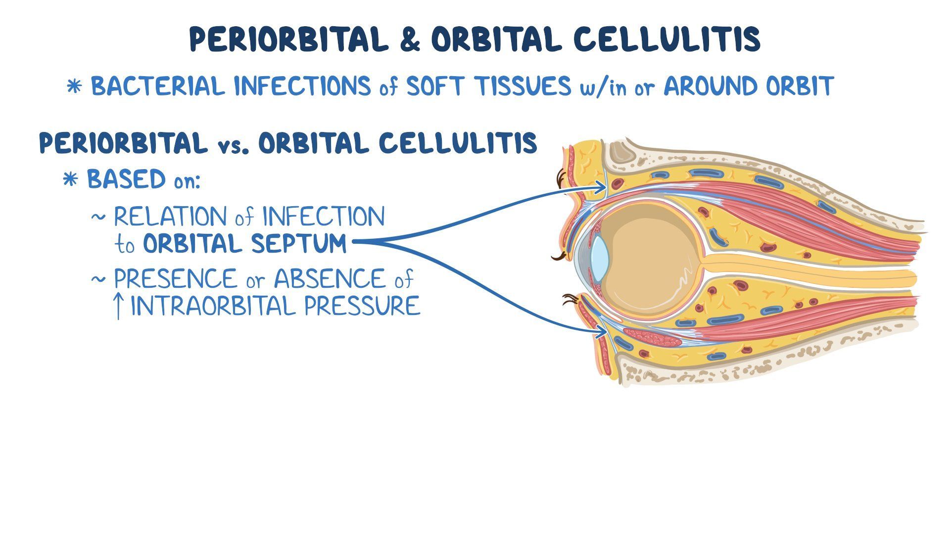 Periorbital Cellulitis Vs Orbital Cellulitis