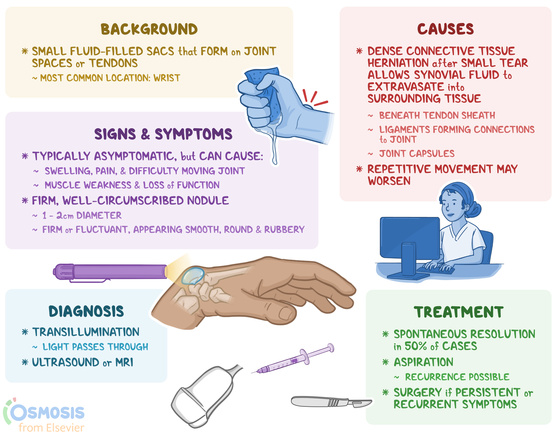 Wrist Ganglion Cyst Treatment