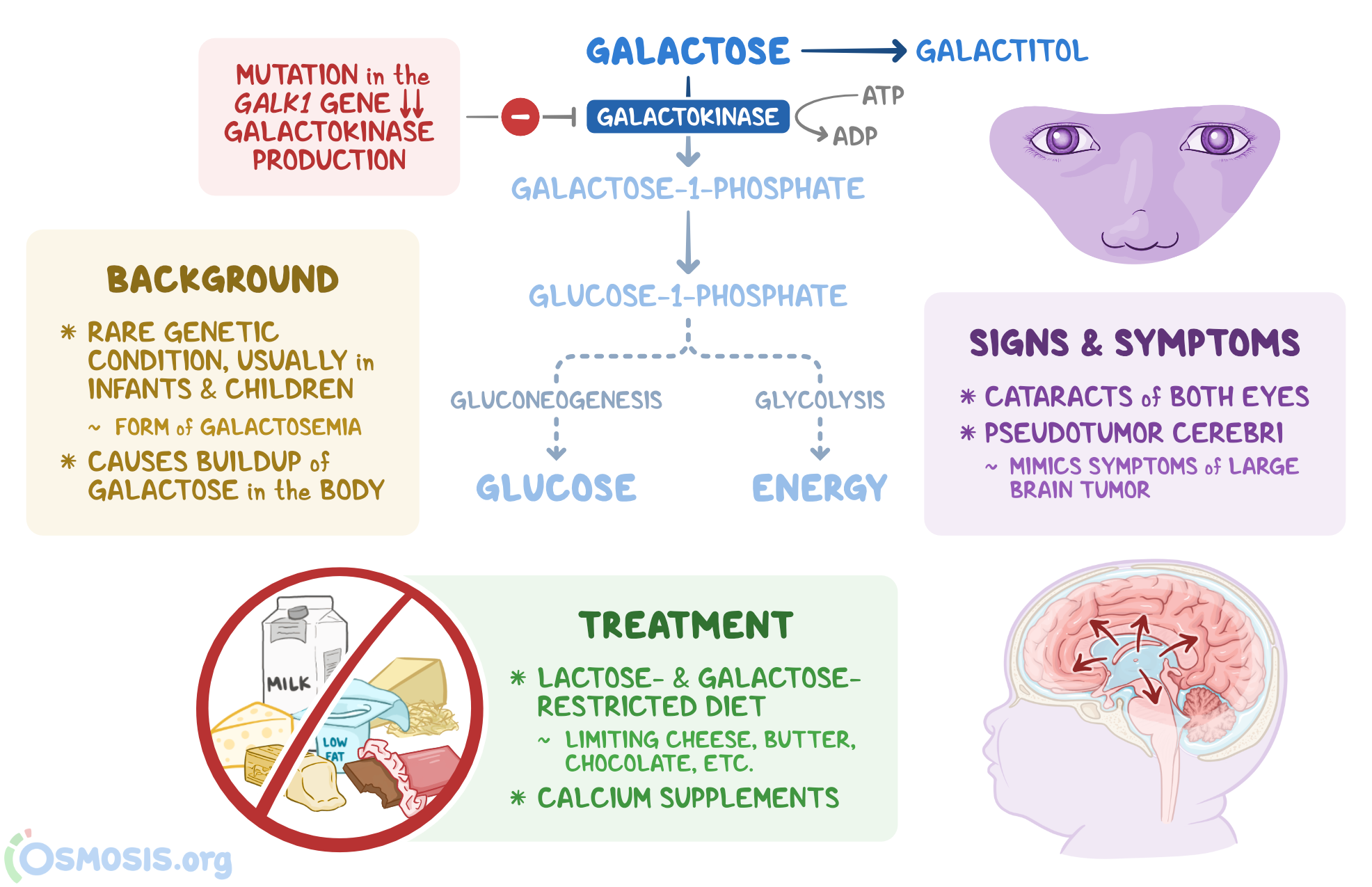 Galactokinase Deficiency: What Is It, Causes, and More | Osmosis
