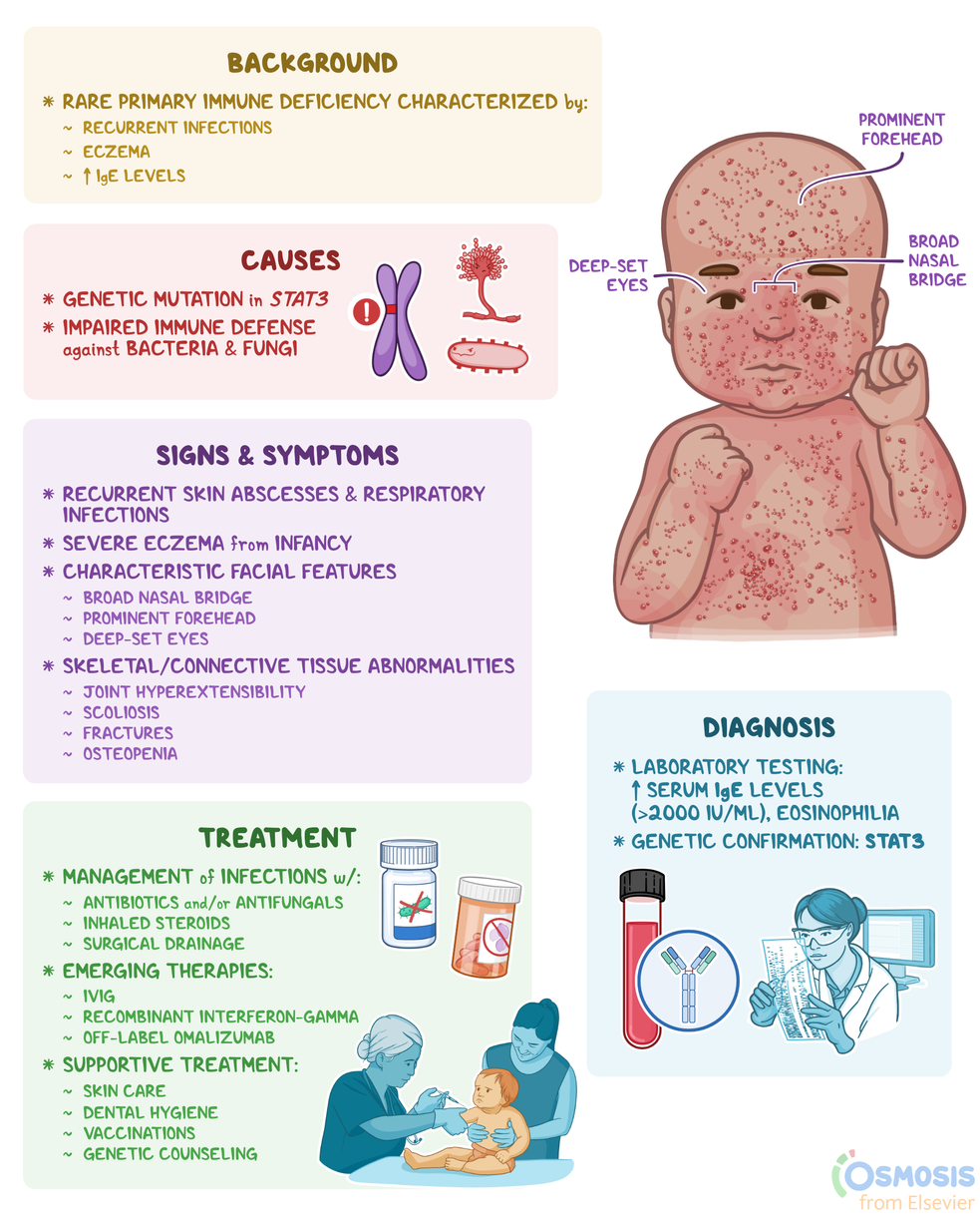 Job Syndrome: What It Is, Causes, Signs and Symptoms, Treatment | Osmosis