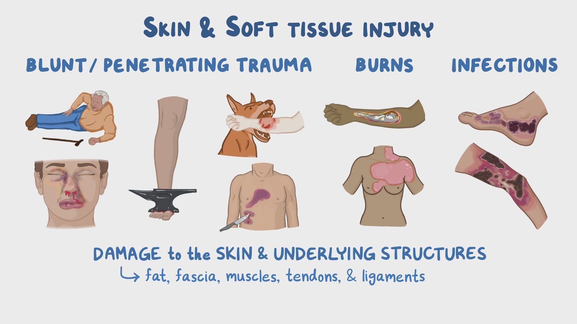 Infections Of The Skin Soft Tissue Muscle And Associated
