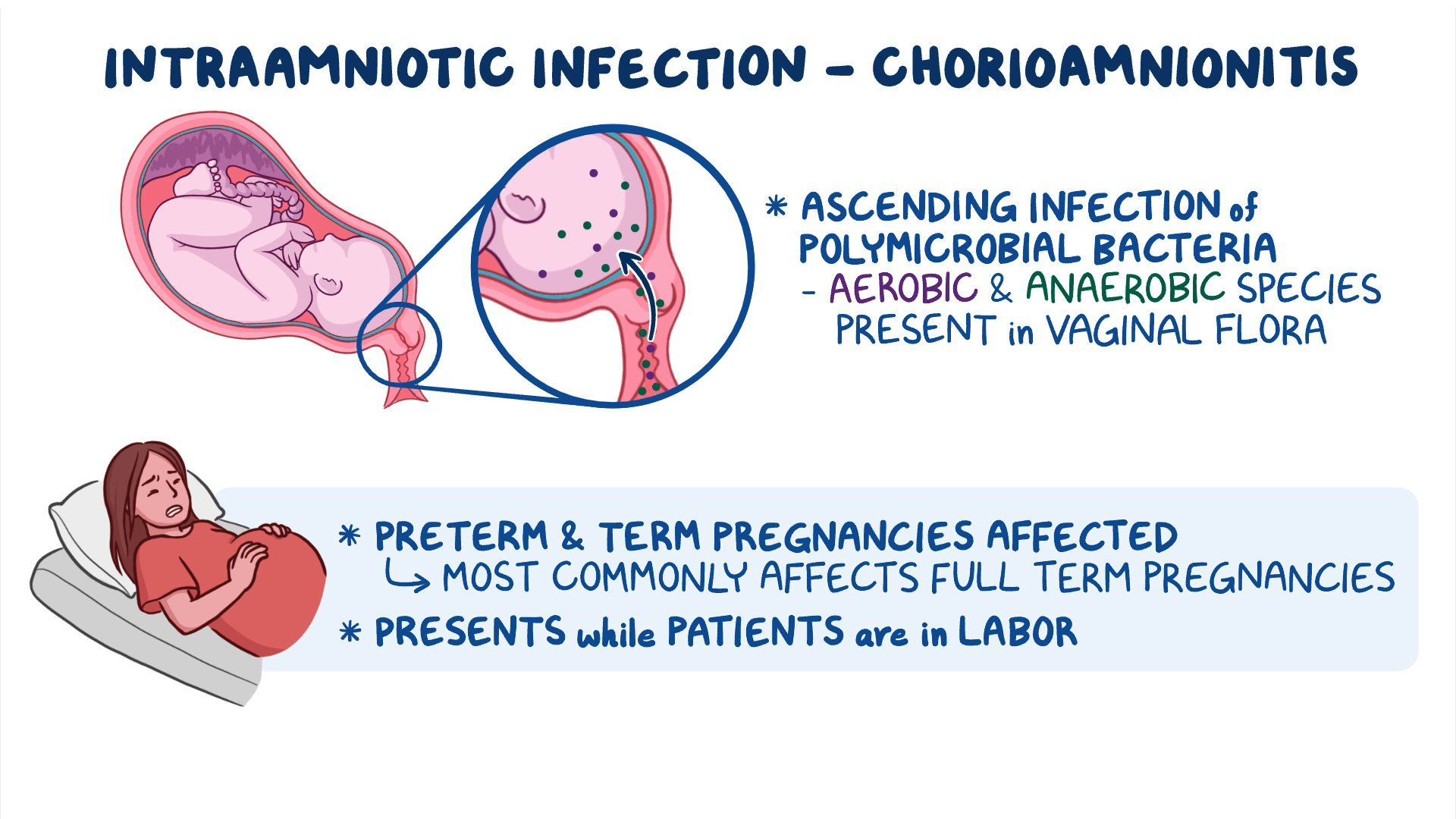 Video: Intraamniotic infection: Clinical sciences | Osmosis