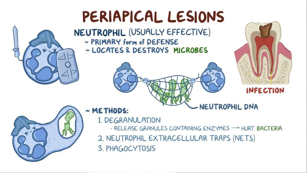 Video: Periapical lesions | Osmosis
