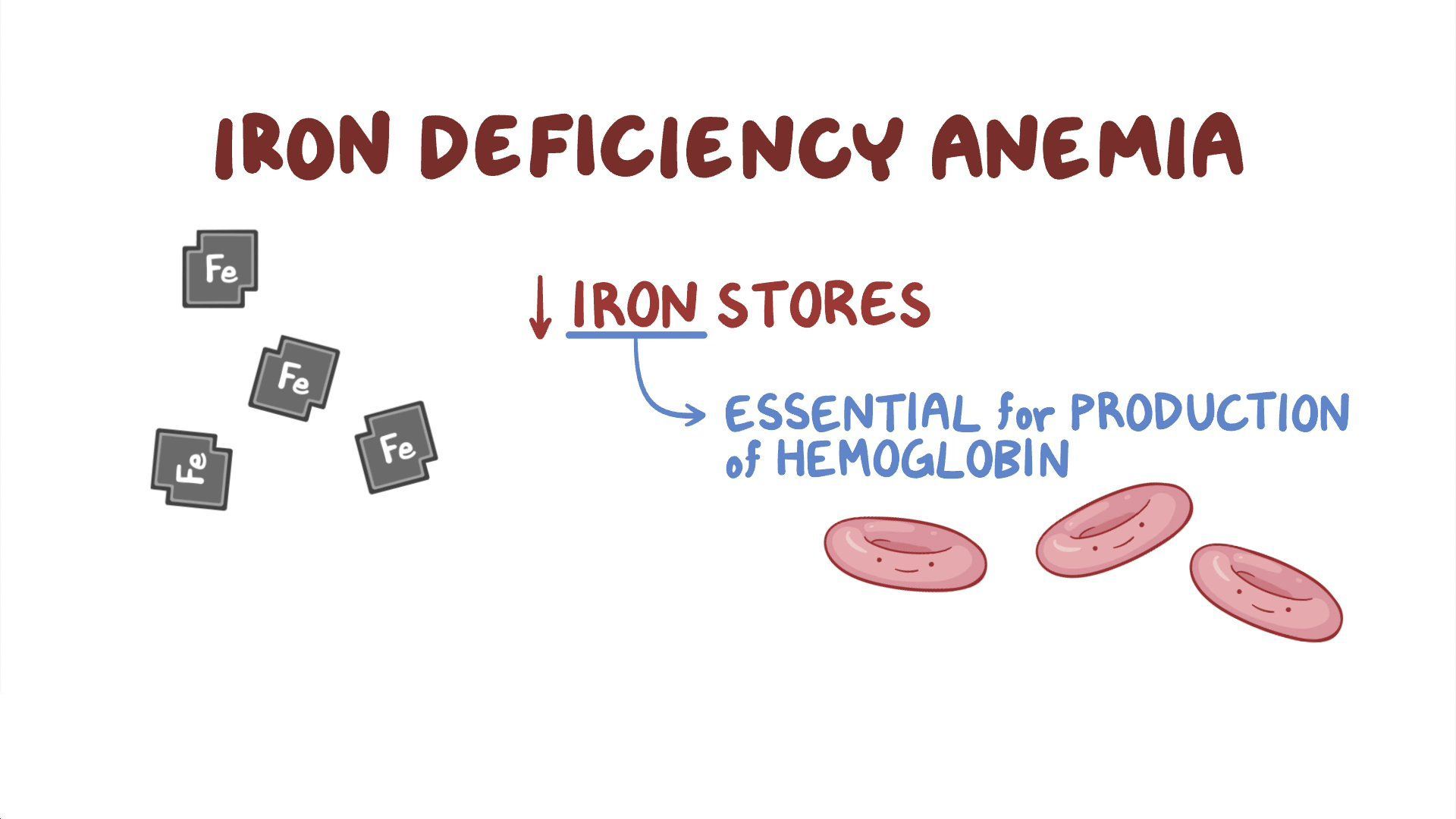Video: Anemia - Iron-deficiency: Nursing | Osmosis