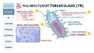 Ghon Complex: What Is It, Causes, Diagnosis, Treatment, and More | Osmosis