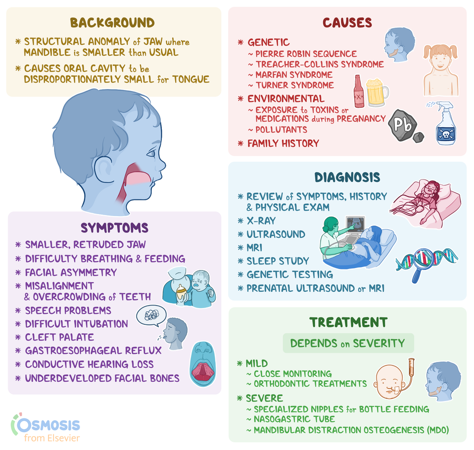 Micrognathia: What Is It, Diagnosis, Treatment, and More | Osmosis