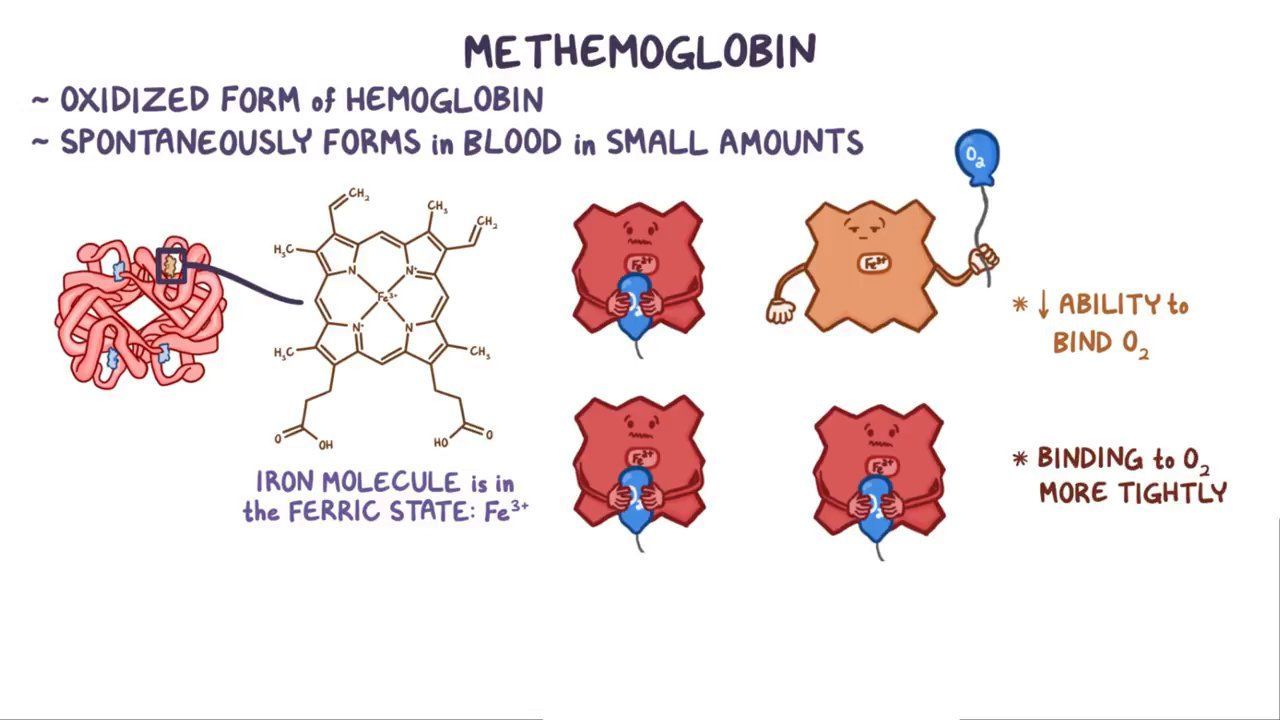 Methemoglobinemia Causes