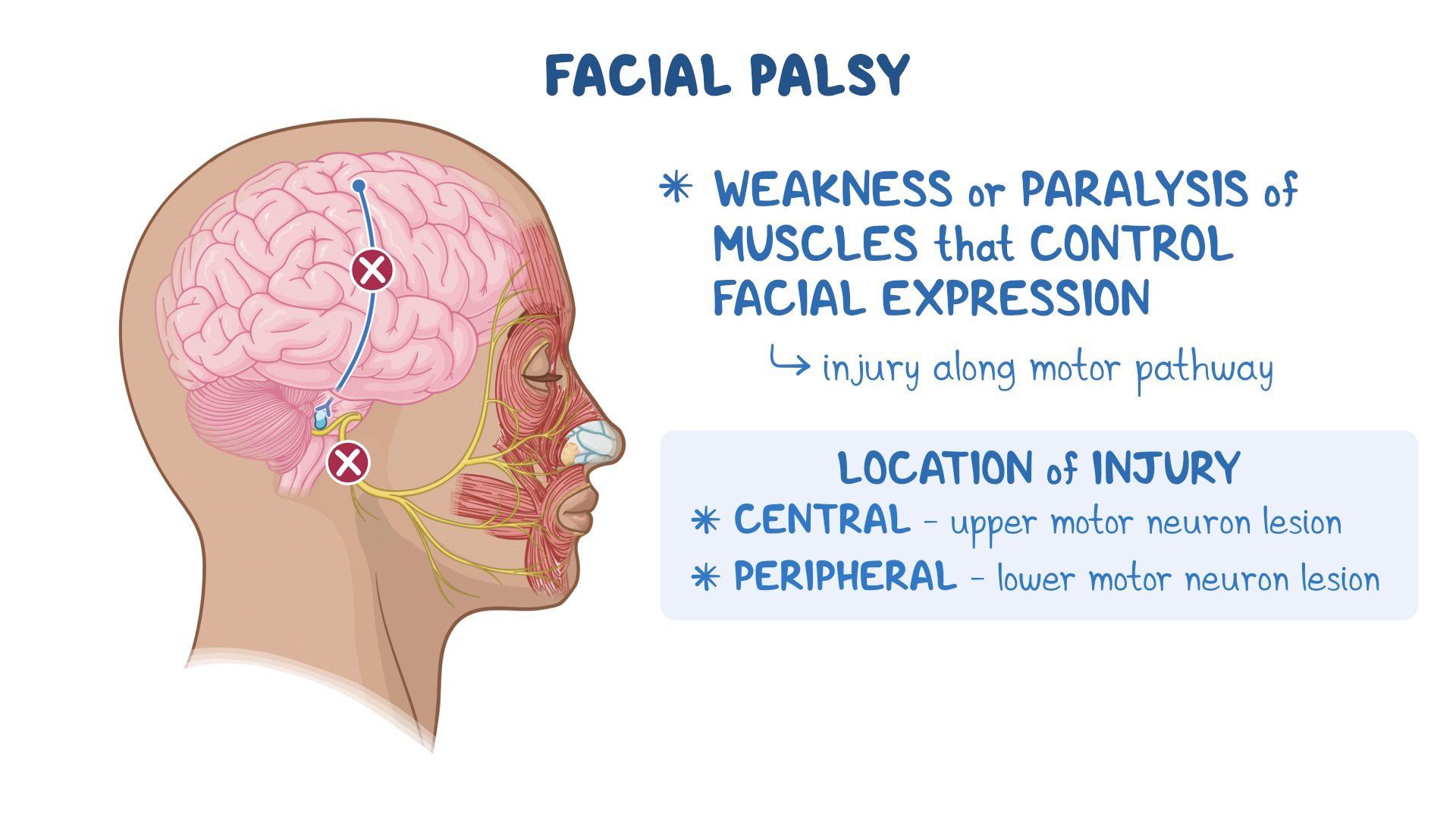 Bilateral Facial Nerve Palsy
