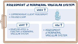 Dorsalis Pedis Artery: What Is It, Location, Supply, and More | Osmosis