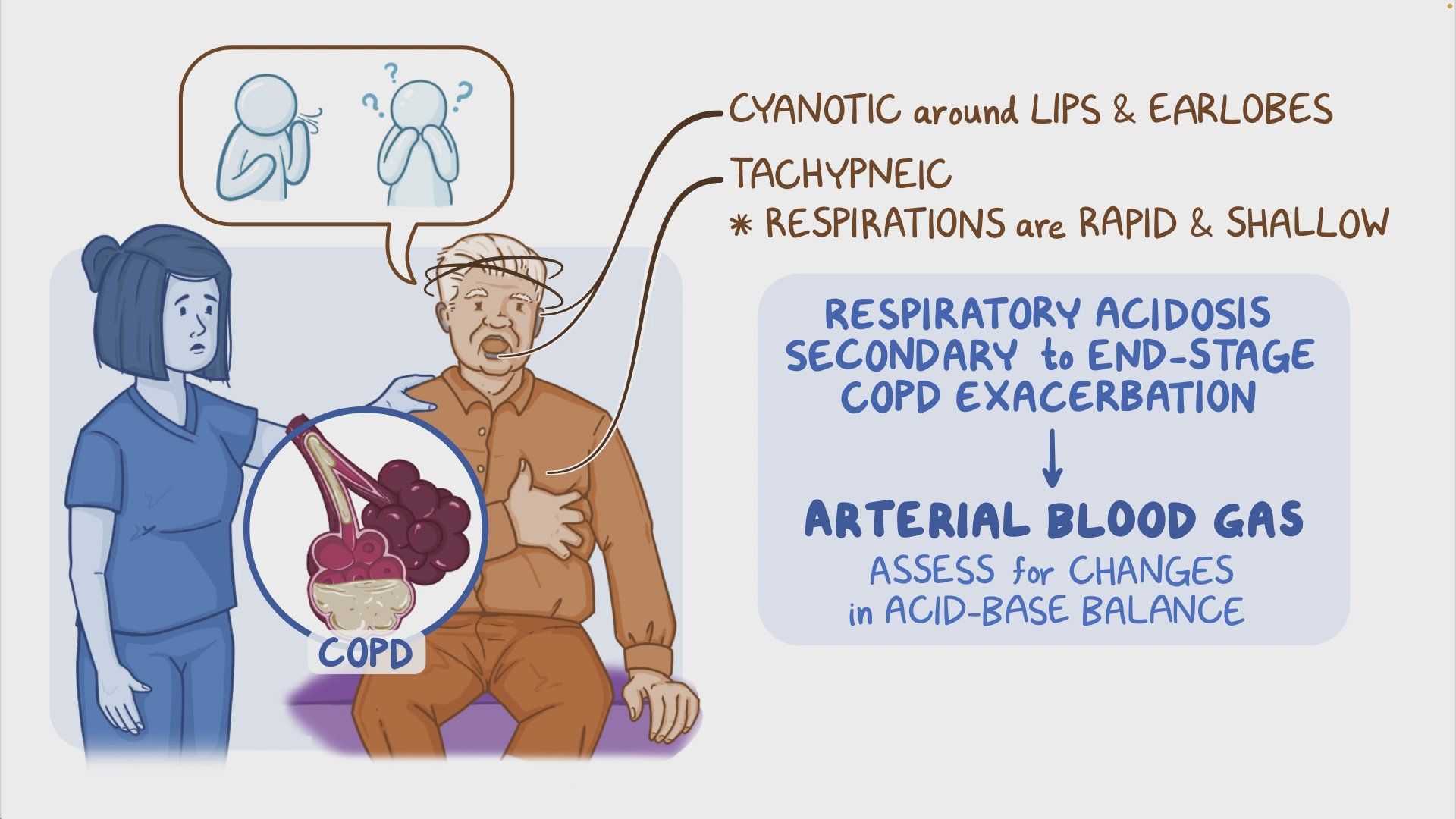 Video: Arterial blood gas (ABG) - Respiratory acidosis: Nursing
