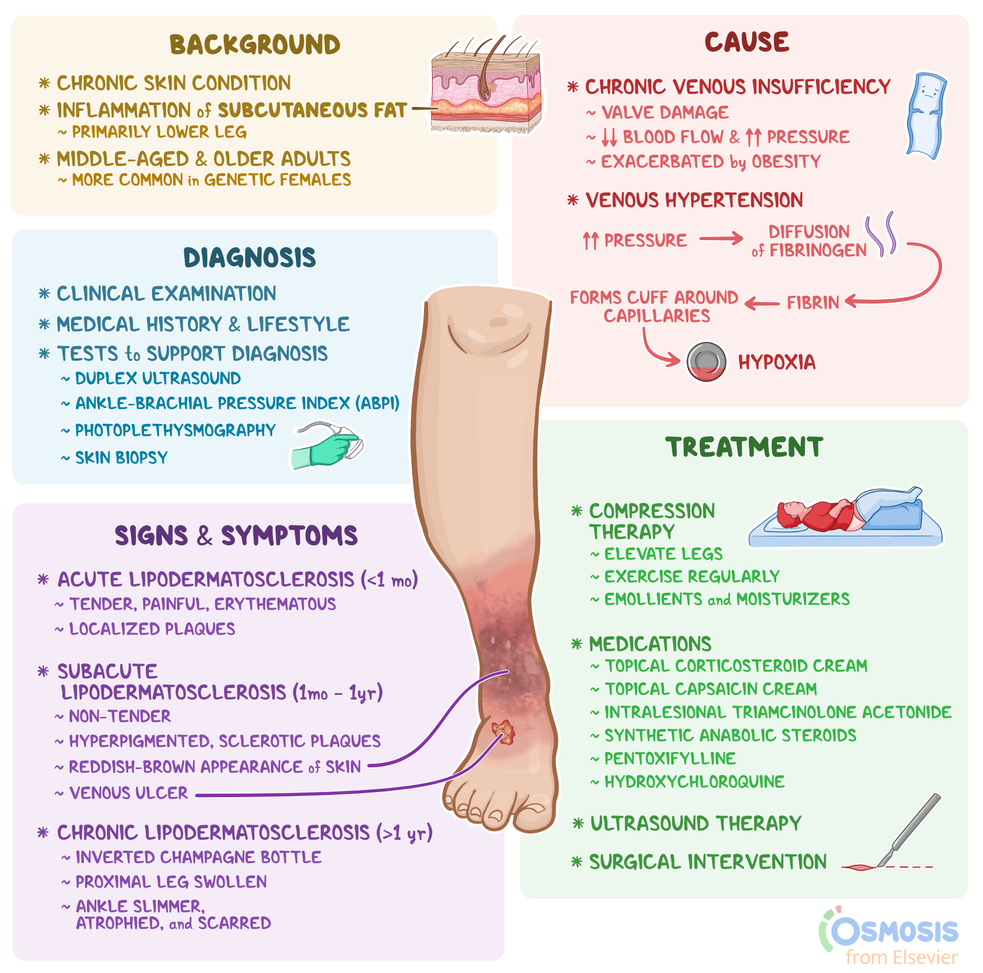 Lipodermatosclerosis: What Is It, Causes, Symptoms, and More | Osmosis