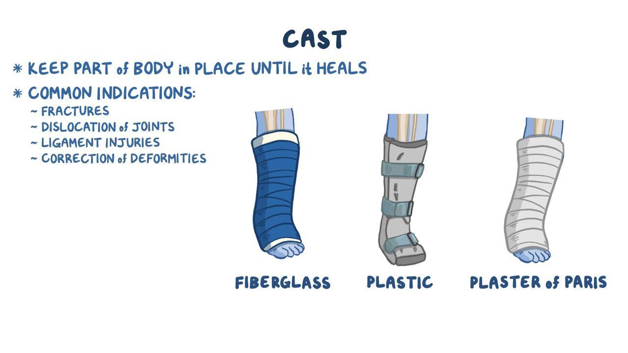 Video: Caring for a client with a cast or traction | Osmosis