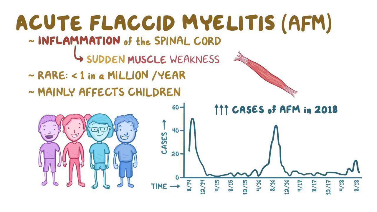 Video: Knowledge Shot: What is acute flaccid myelitis, the polio-like ...