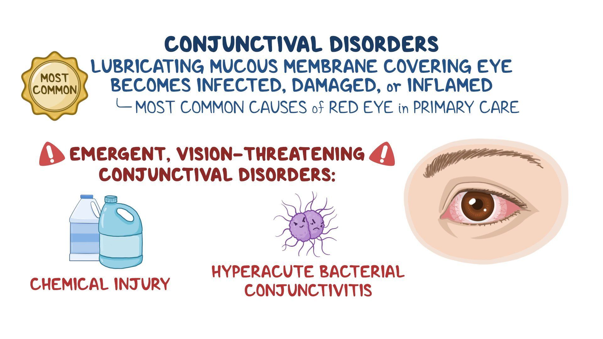 Video: Conjunctival disorders: Clinical sciences