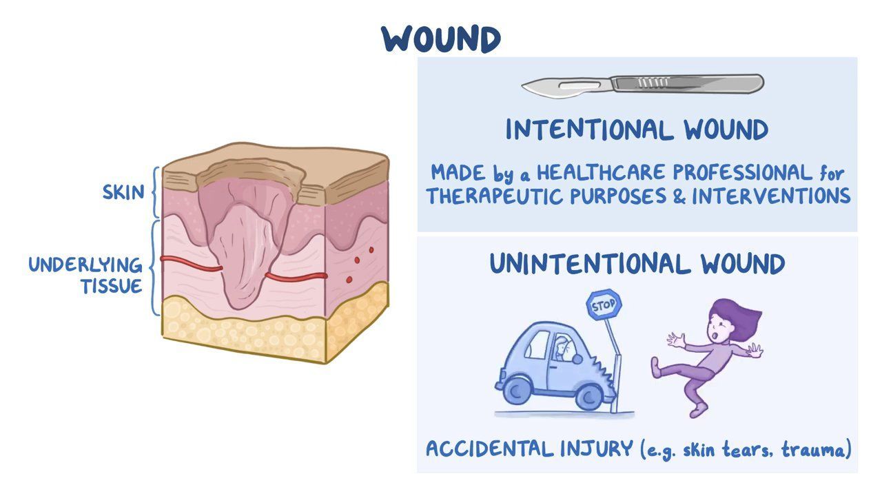 Video: Integumentary system: Wounds | Osmosis