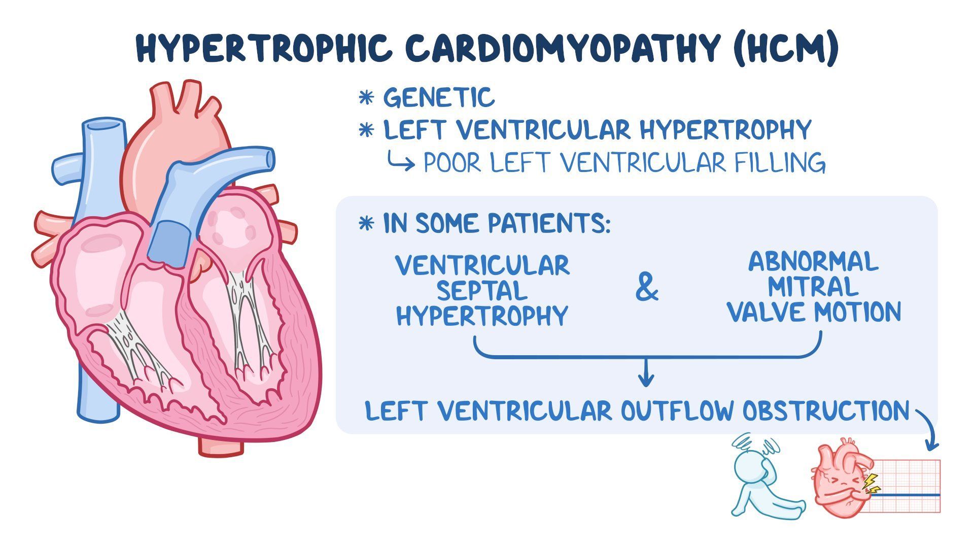 Video: Hypertrophic cardiomyopathy: Clinical sciences | Osmosis