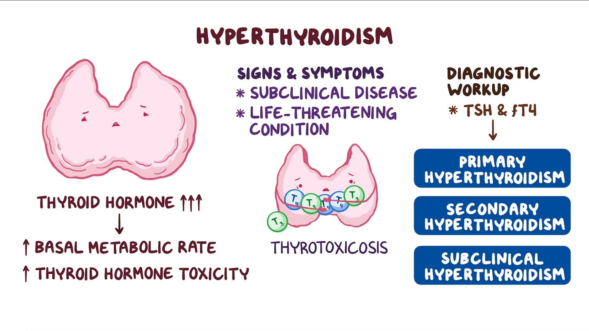 Video: Approach to hyperthyroidism and thyrotoxicosis: Clinical sciences | Osmosis
