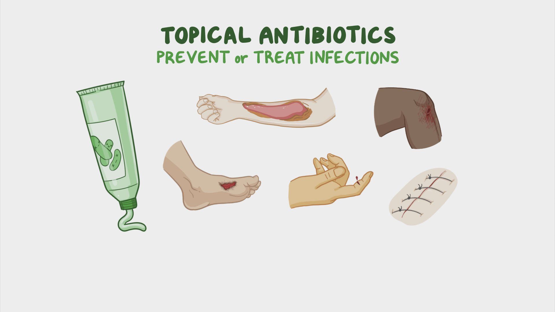 Video: Antibiotics - Topical: Nursing pharmacology | Osmosis