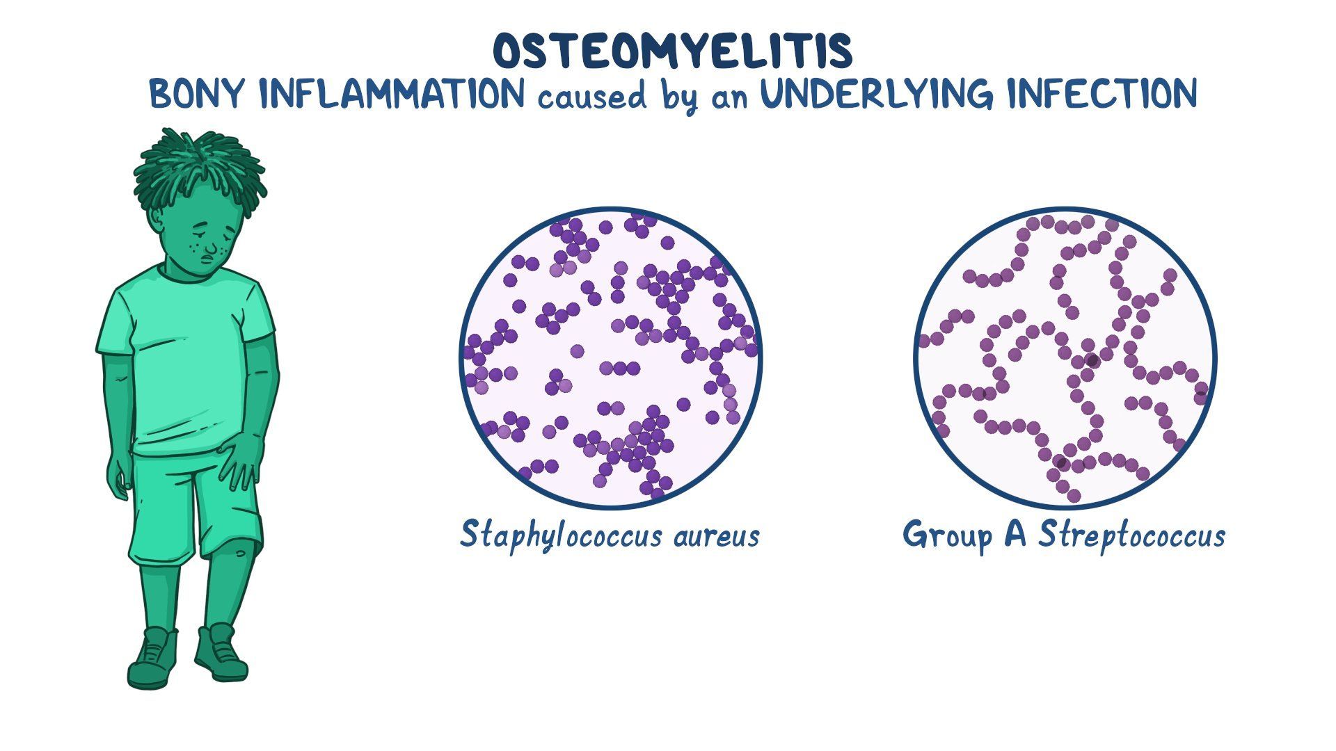 Video: Osteomyelitis (pediatrics): Clinical sciences | Osmosis