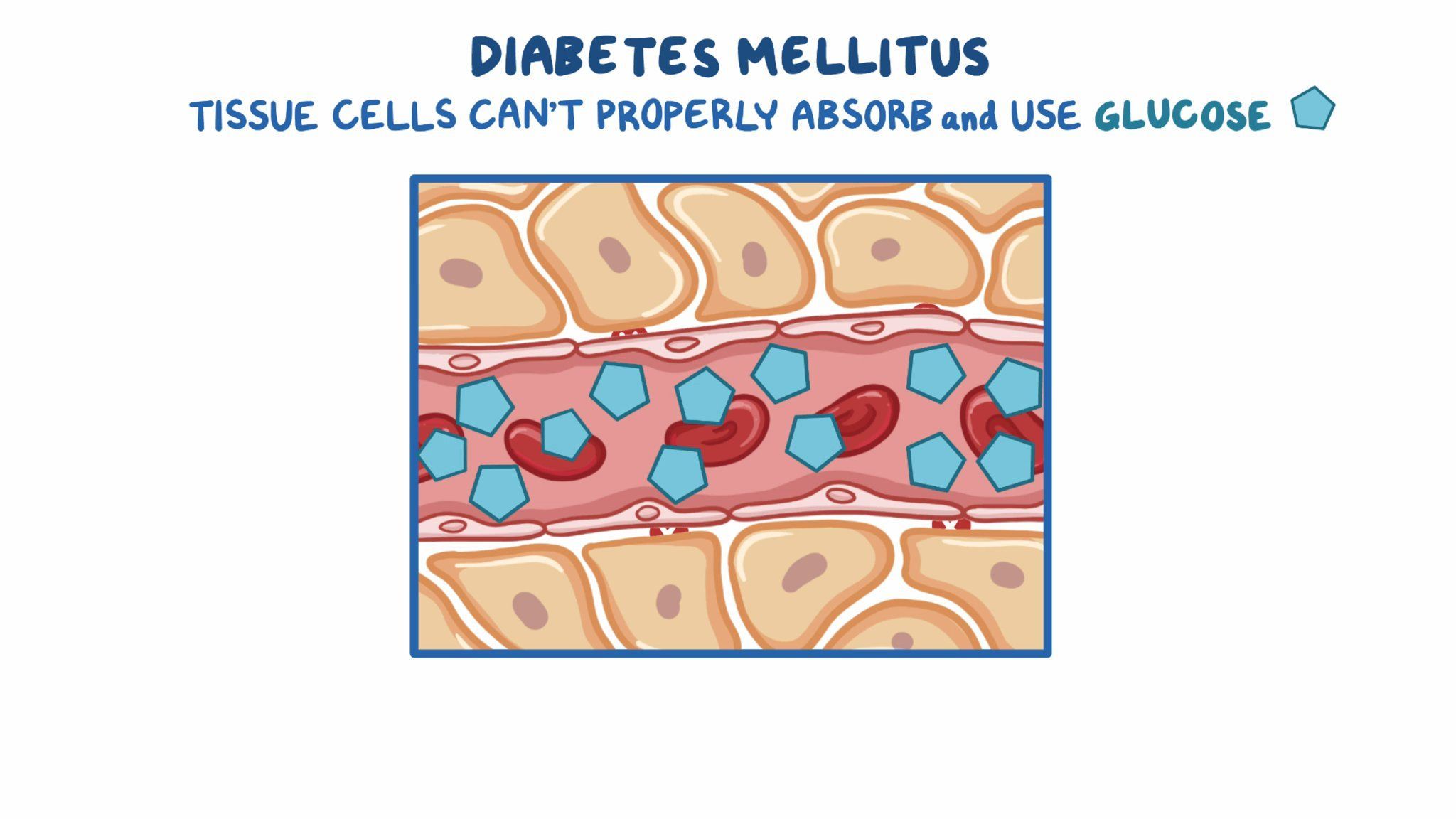 Type 1 And Type 2 Diabetes Animation