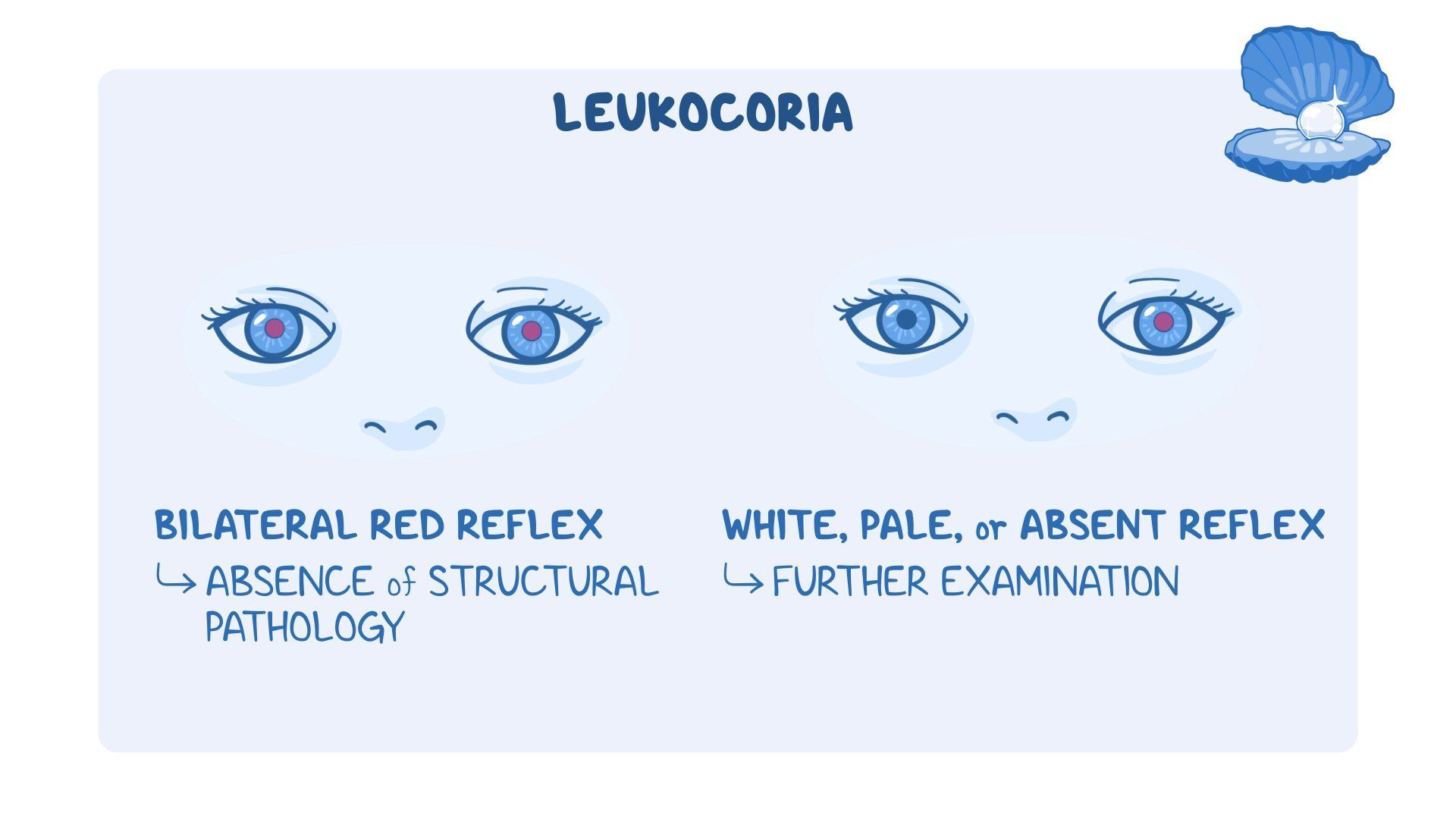 Video: Approach to leukocoria (pediatrics): Clinical sciences | Osmosis
