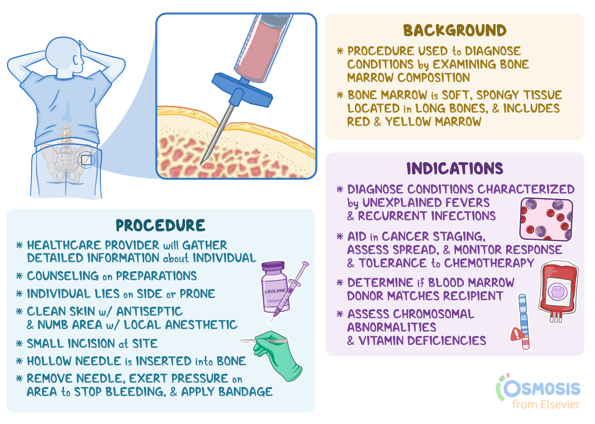 Bone Marrow Aspiration: What Is It, How It’s Done, and More | Osmosis
