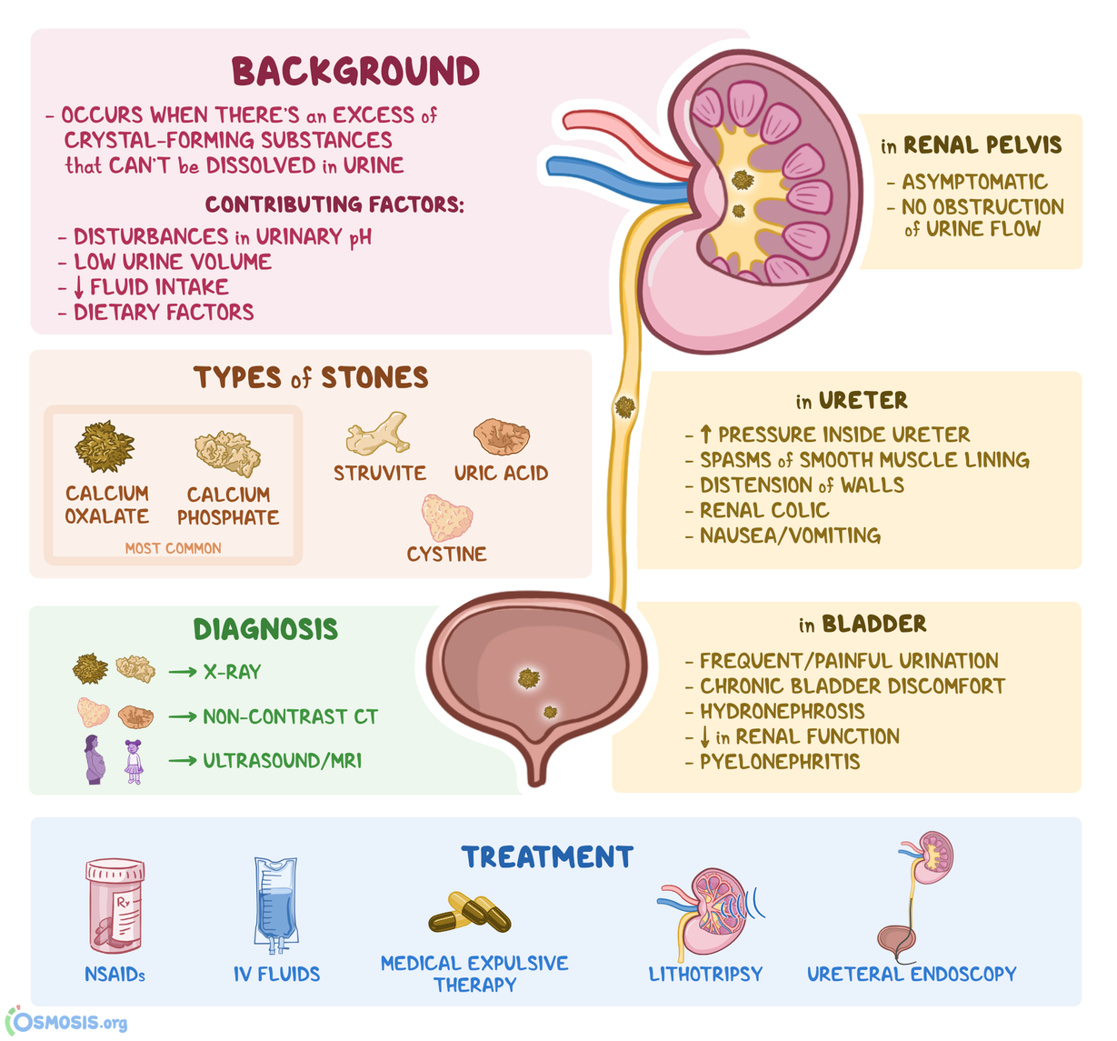 Nephrolithiasis What Is It Types Signs And Symptoms Diagnosis Nephrolithiasis What Is It Types Signs And Symptoms Diagnosis