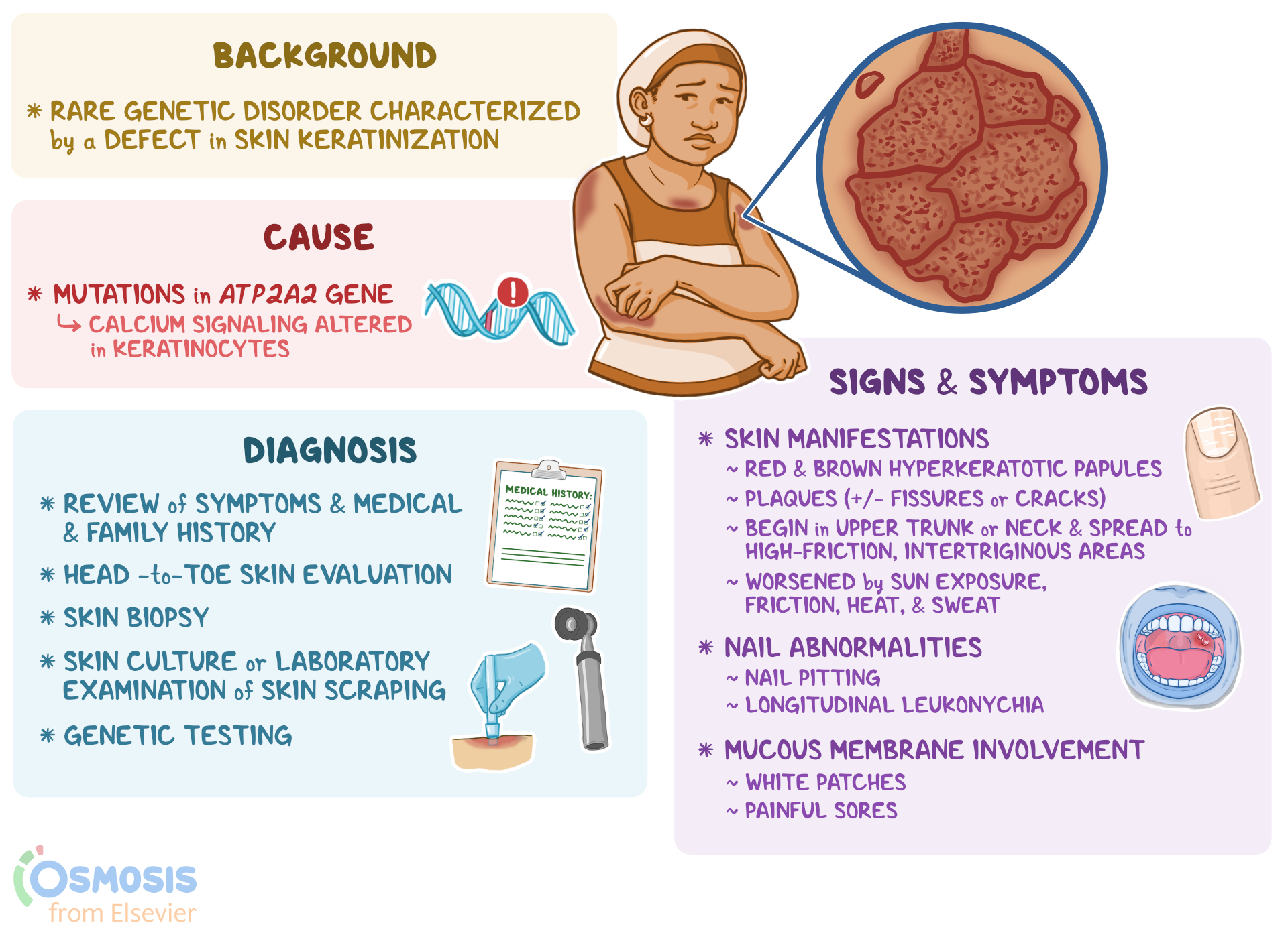 Darier Disease: What It Is, Causes, Signs and Symptoms, and More | Osmosis