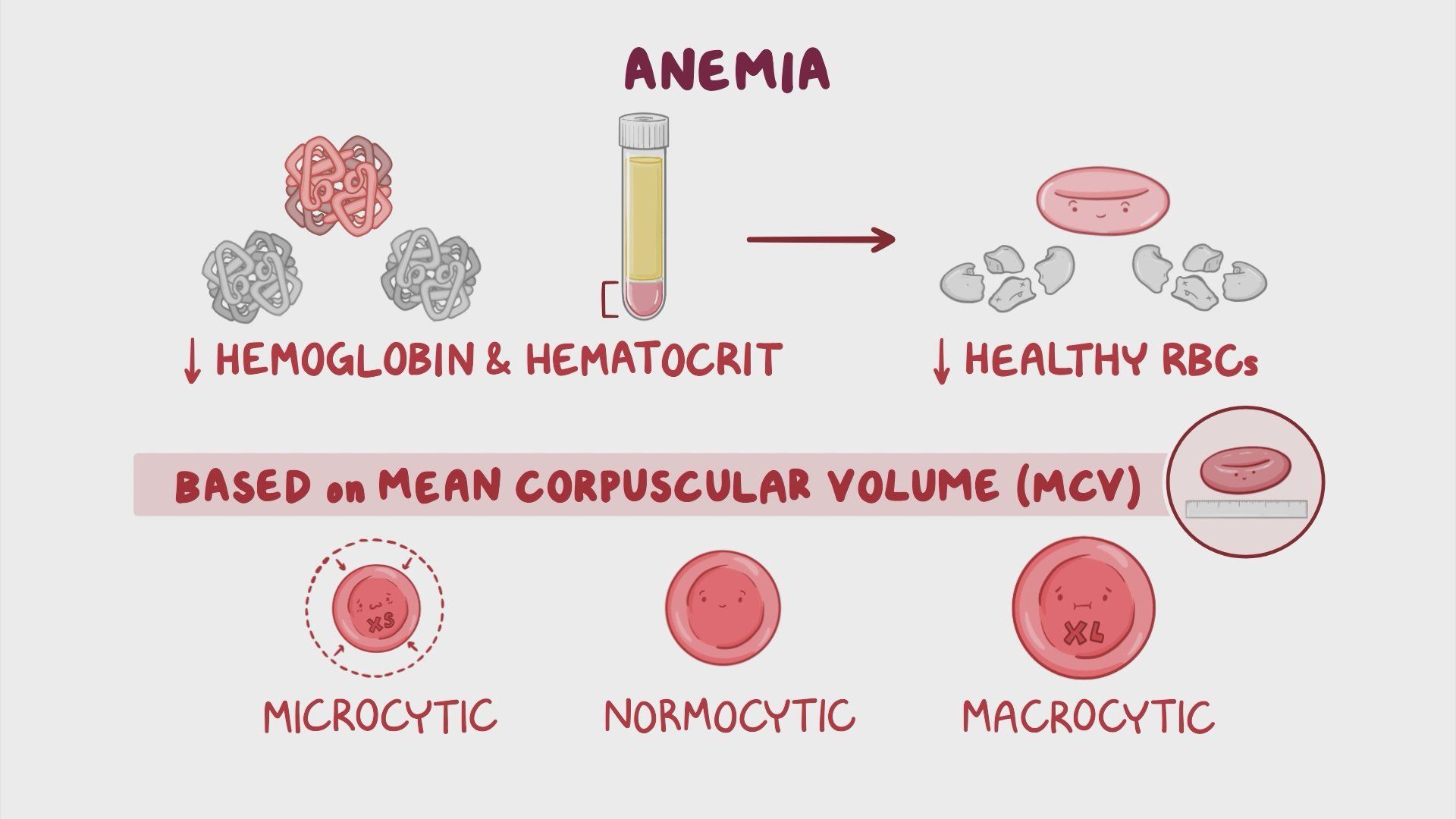Video: Approach to anemia in the newborn and infant (underproduction ...
