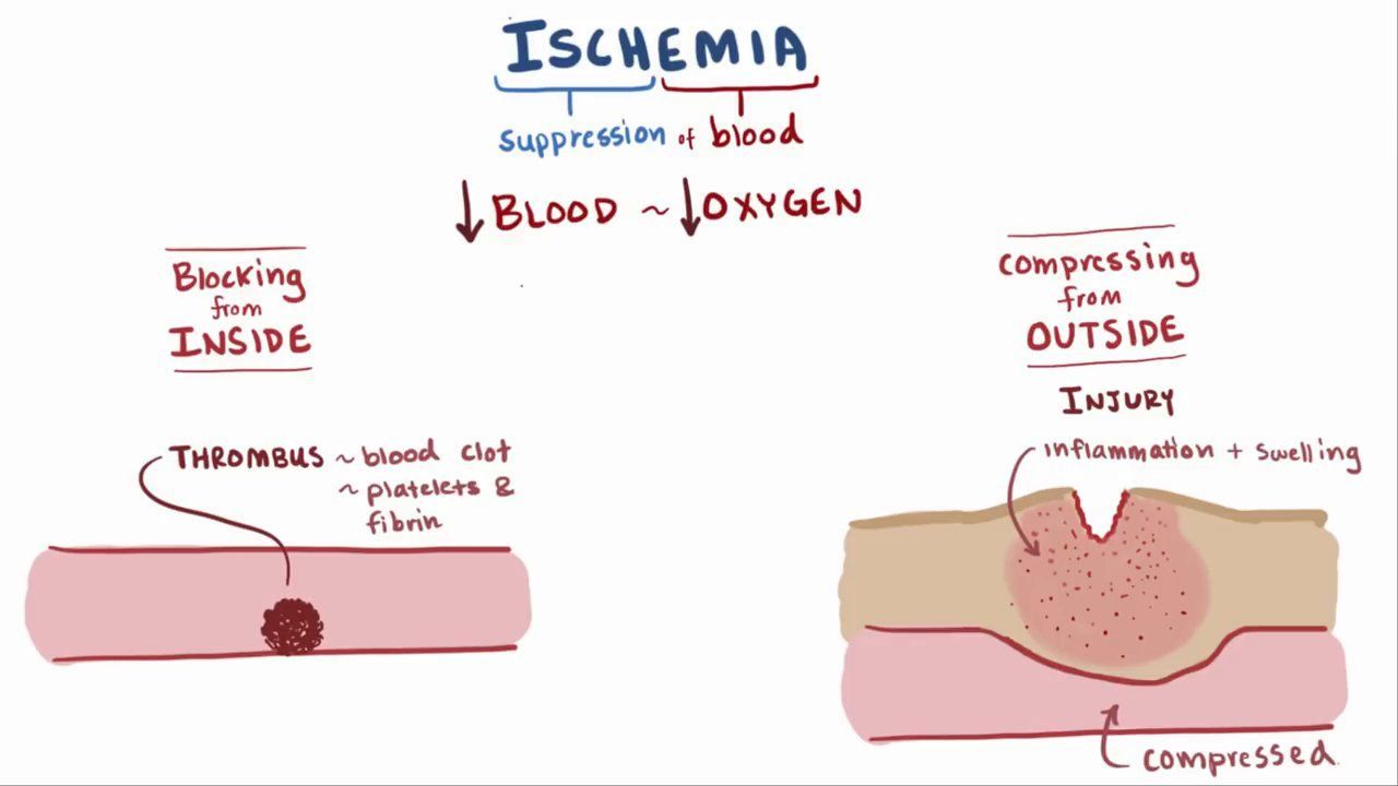 Video Ischemia Osmosis