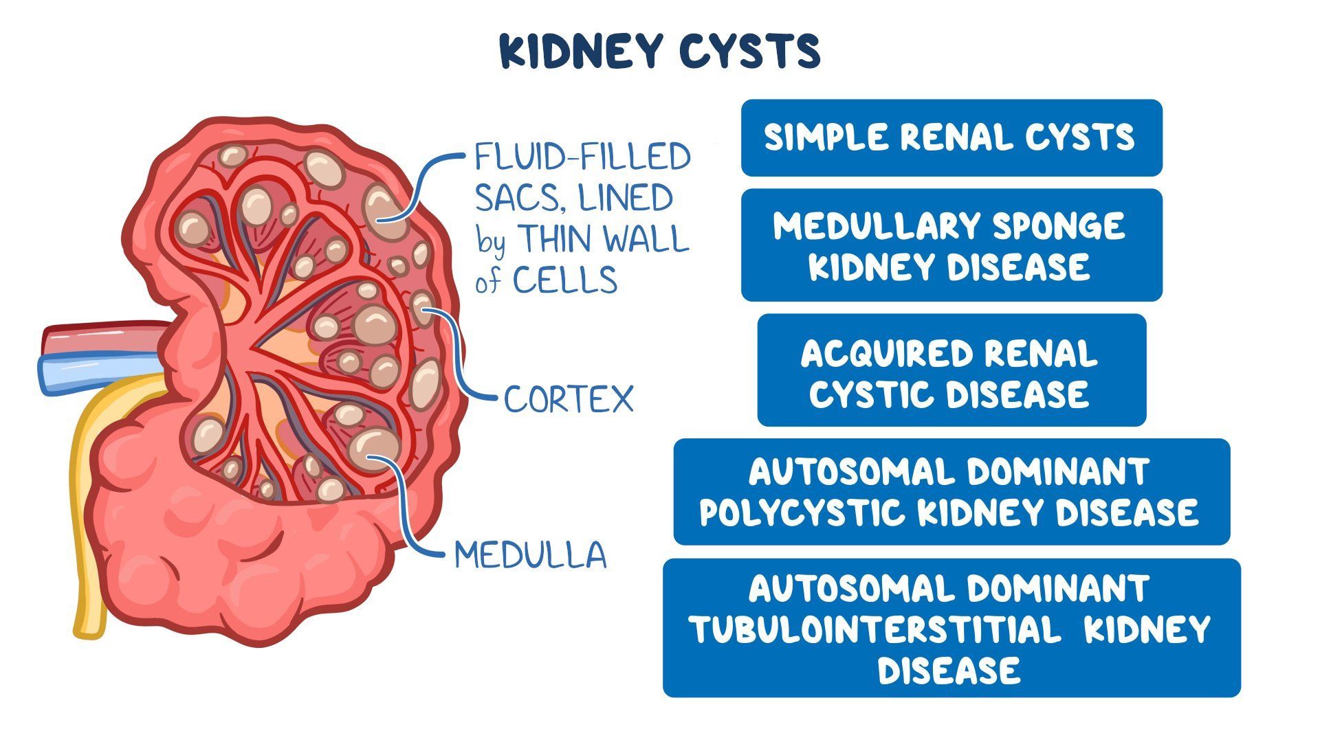 Kidney Cysts Symptoms Diagnosis And Treatment