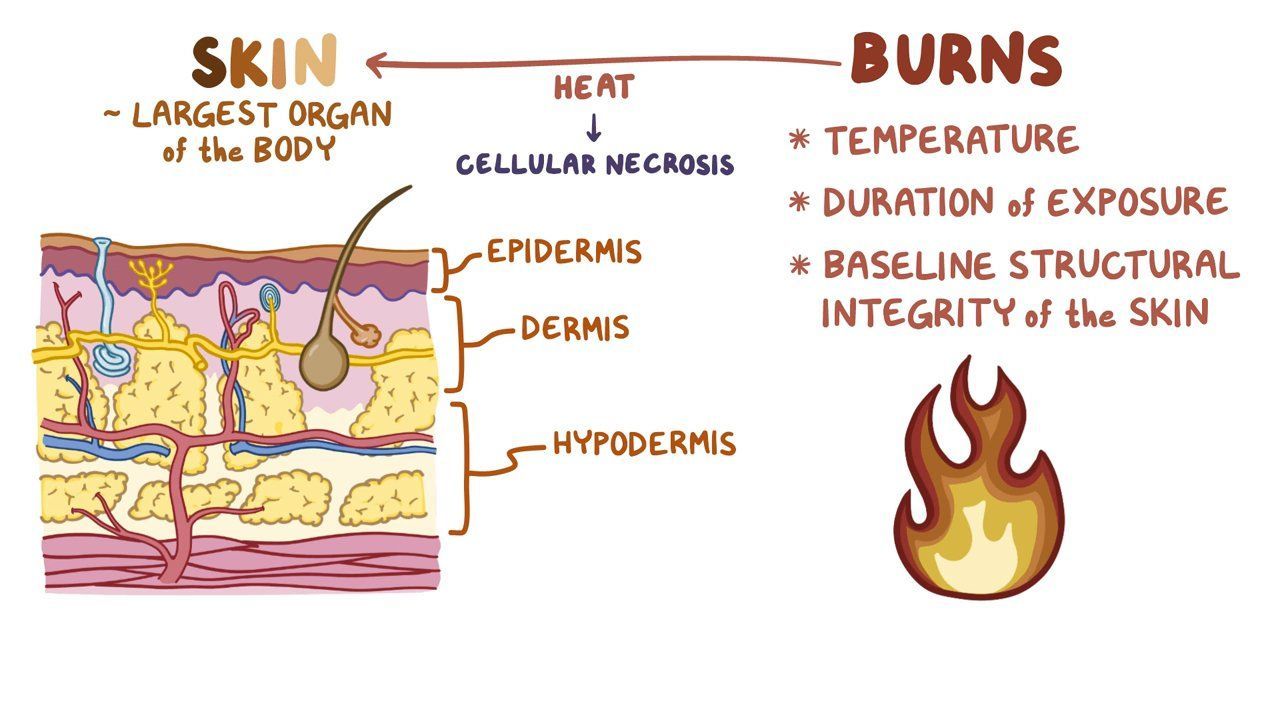 Video: Burns: Clinical