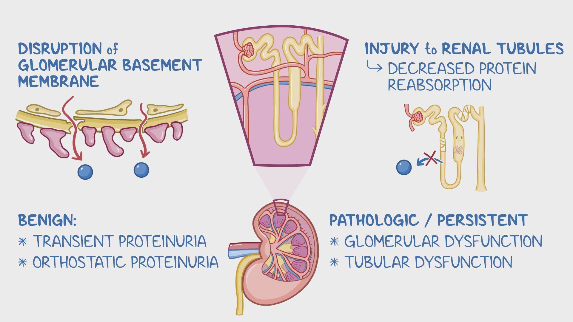 Video: Approach to proteinuria (pediatrics): Clinical sciences | Osmosis