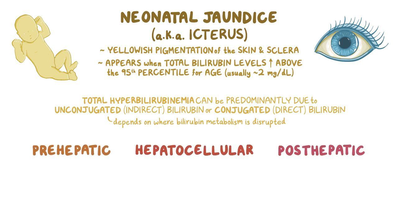 Neonatal jaundice: Clinical practice - Osmosis