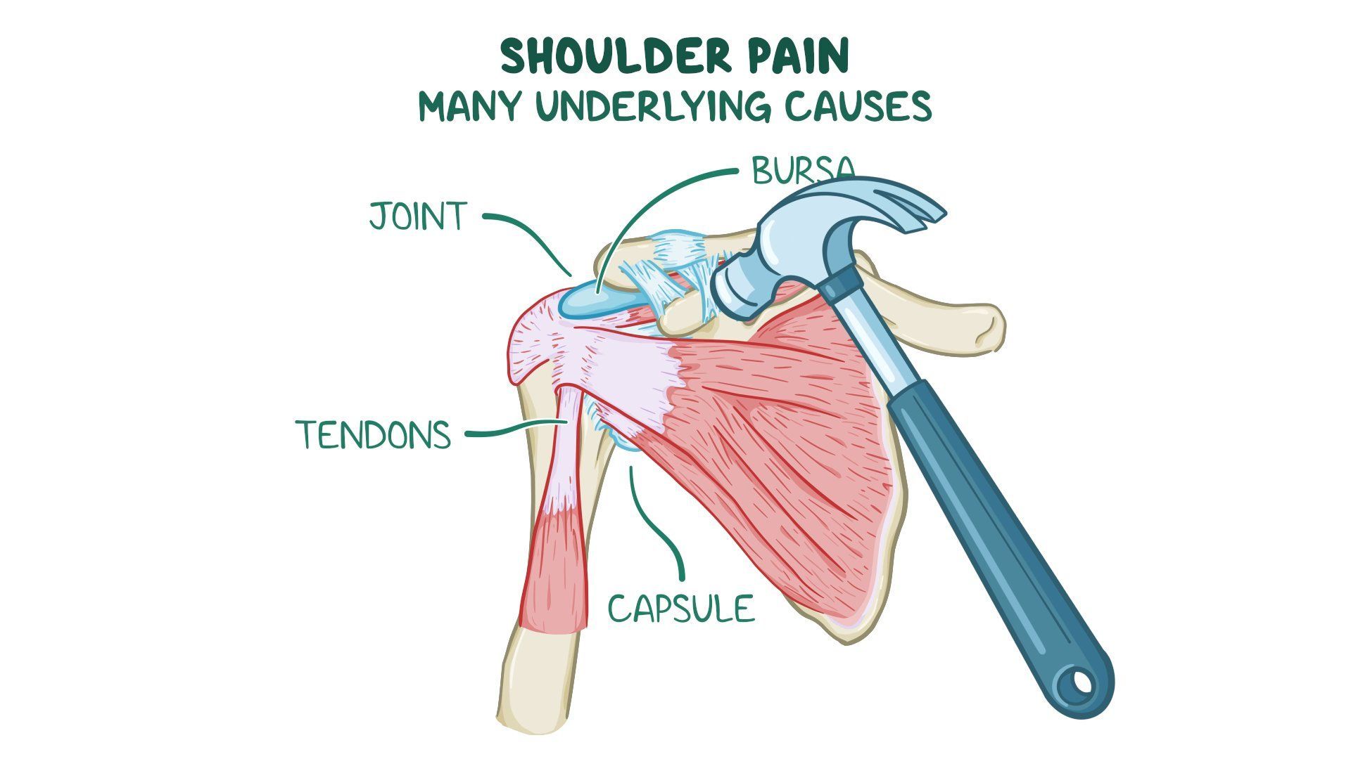Video: Approach to shoulder pain: Clinical sciences | Osmosis