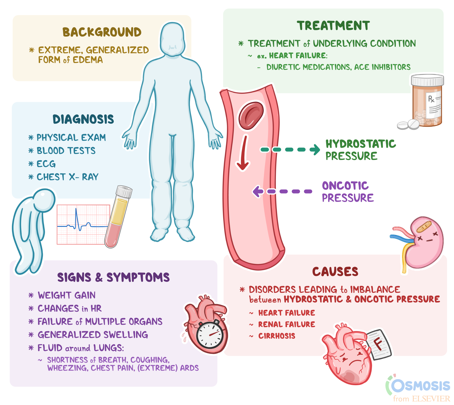 Anasarca: What Is It, Causes, Signs, Symptoms, and More | Osmosis