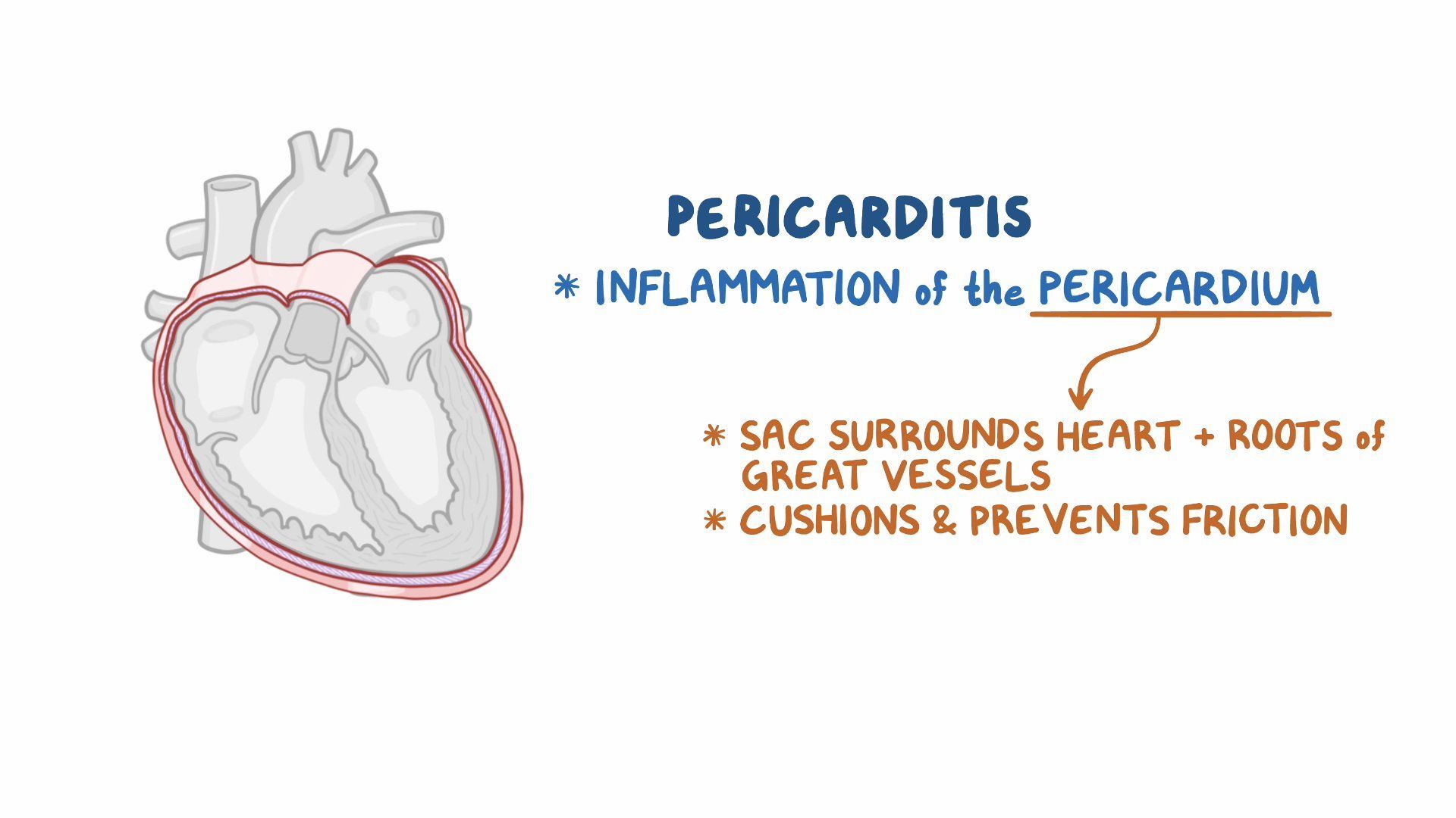 Video: Pericarditis: Nursing | Osmosis