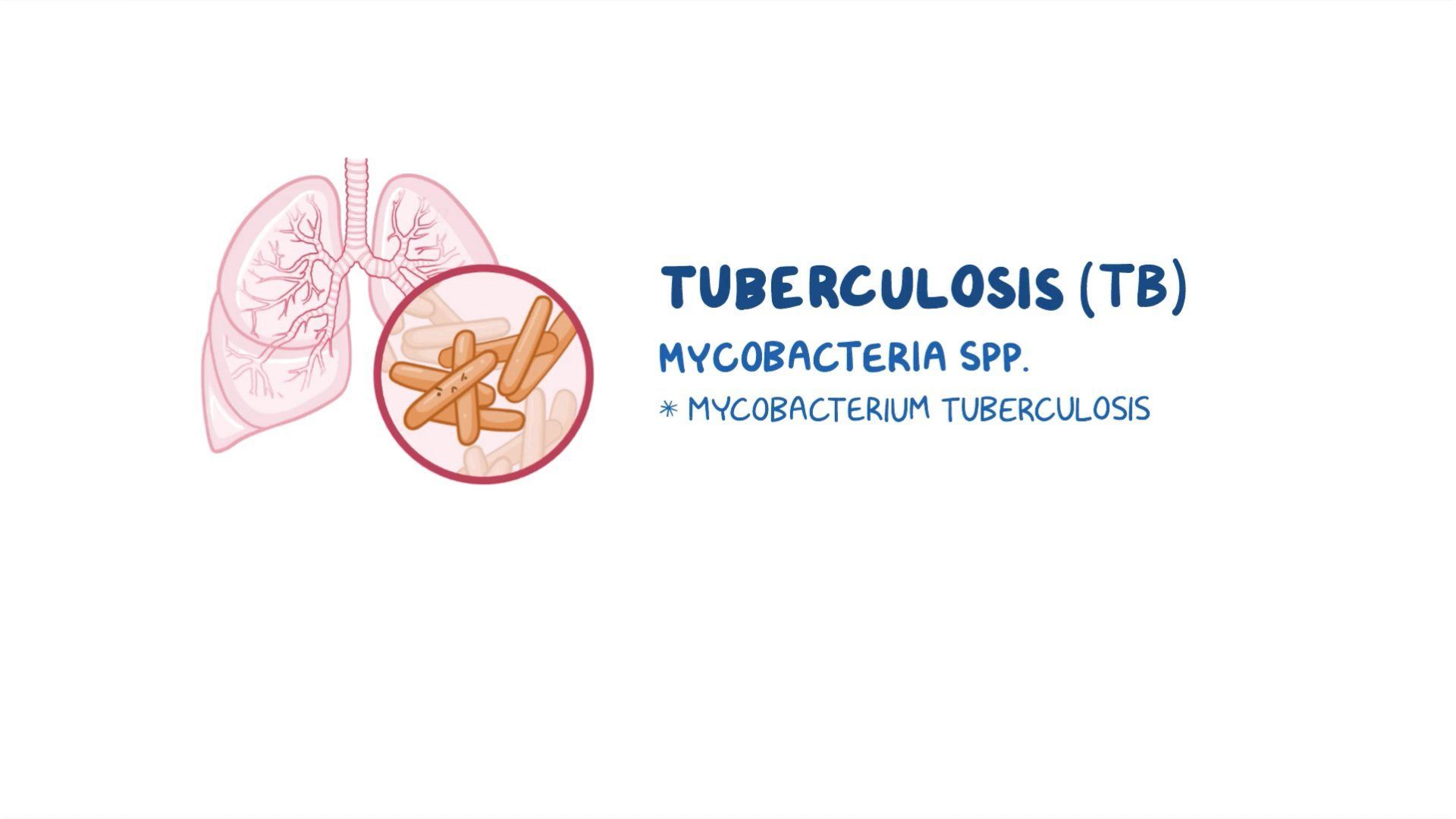 Video: Tuberculosis (TB): Nursing | Osmosis