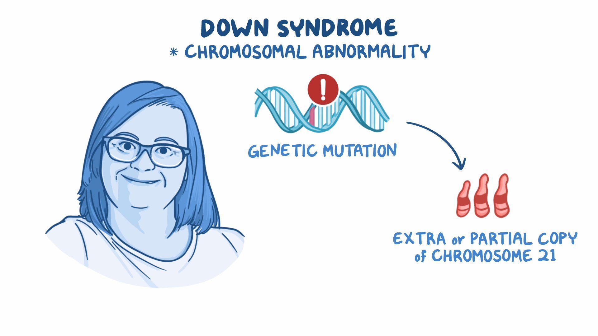 Video: Down syndrome: Nursing | Osmosis