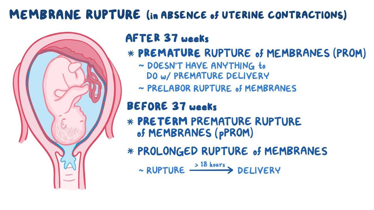 Video Premature Rupture Of Membranes Clinical Osmosis
