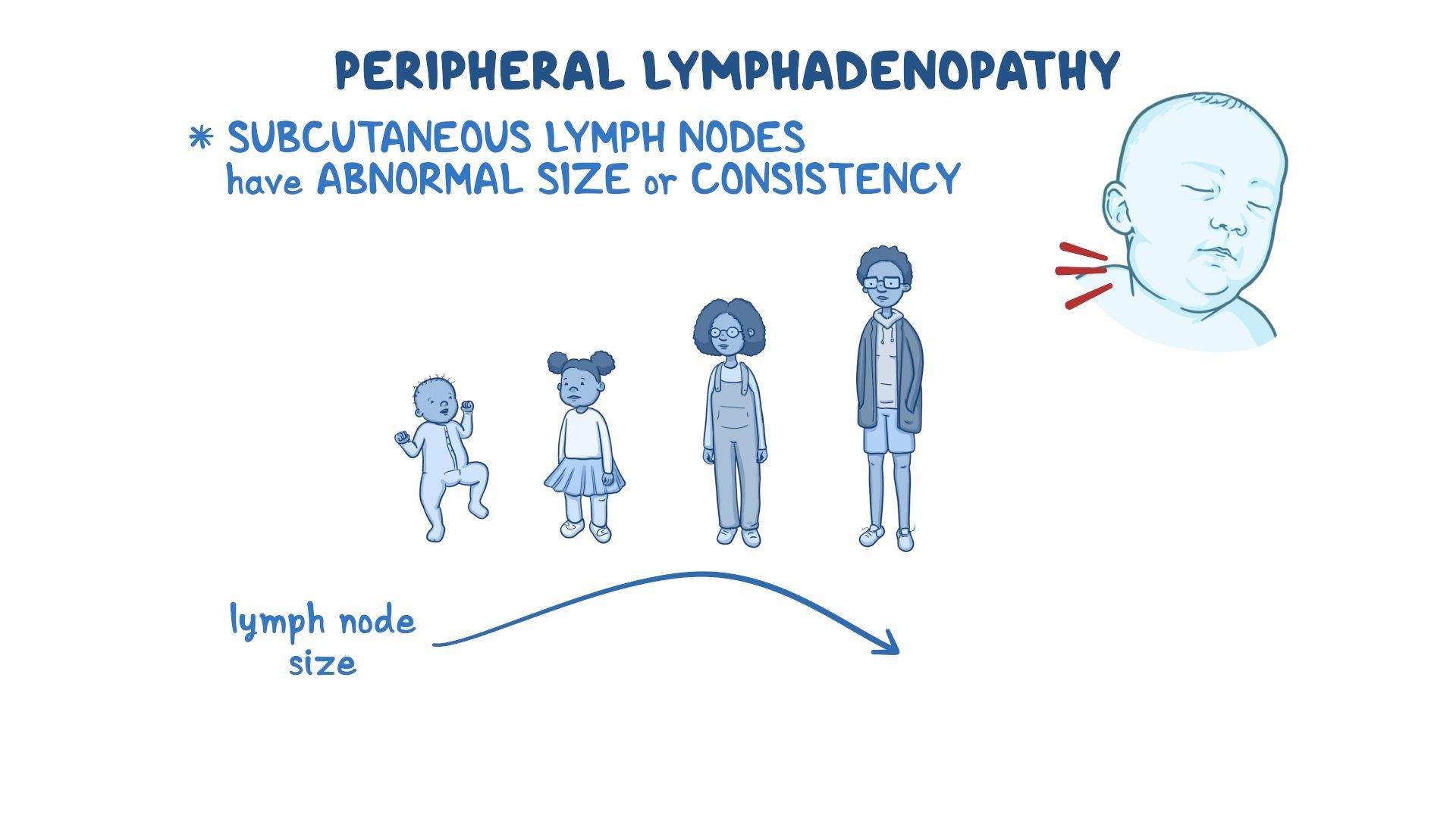 Video: Approach to peripheral lymphadenopathy (pediatrics): Clinical ...