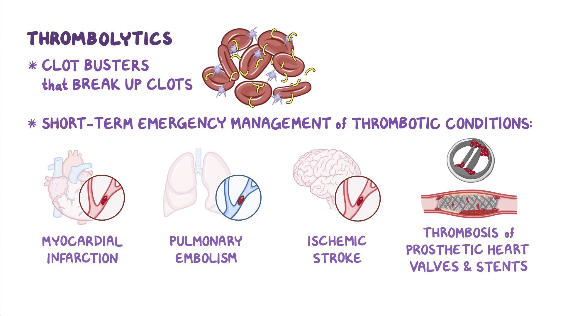 Video: Thrombolytics: Nursing pharmacology | Osmosis