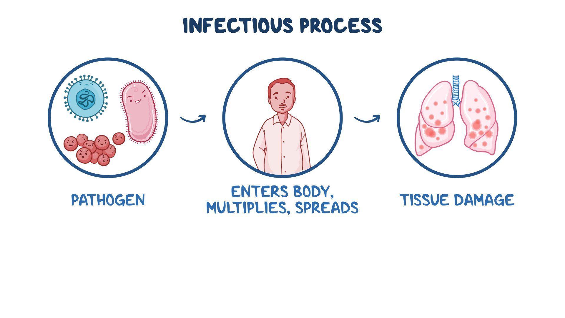 Video: The Infectious Process | Osmosis