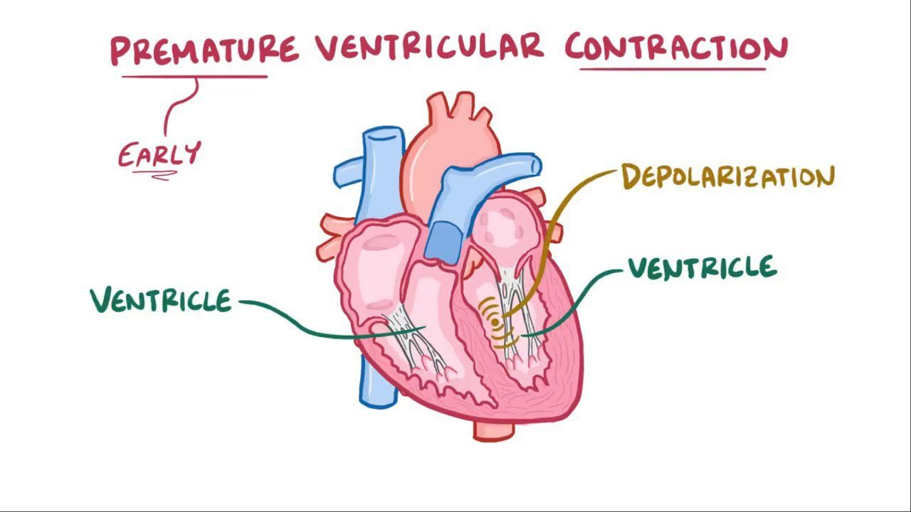 You Make My Heart Have Premature Ventricular Contractions