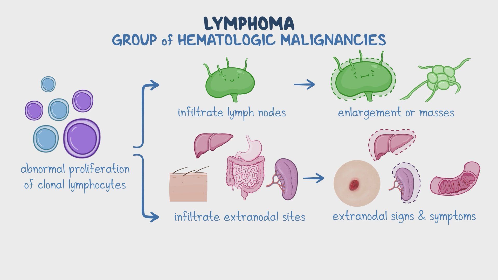 Video: Approach to lymphoma: Clinical sciences | Osmosis