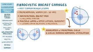 LMNOP: Breast Assessment Mnemonic | Osmosis