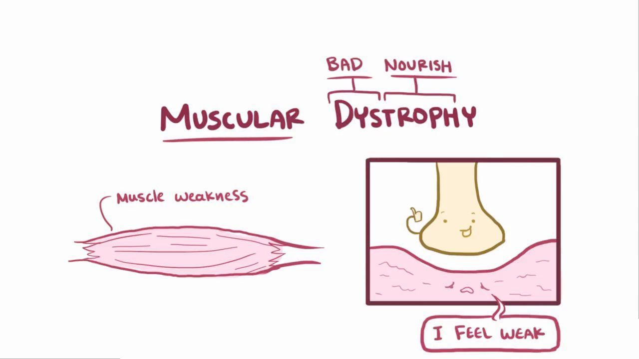 Video: Muscular dystrophy | Osmosis