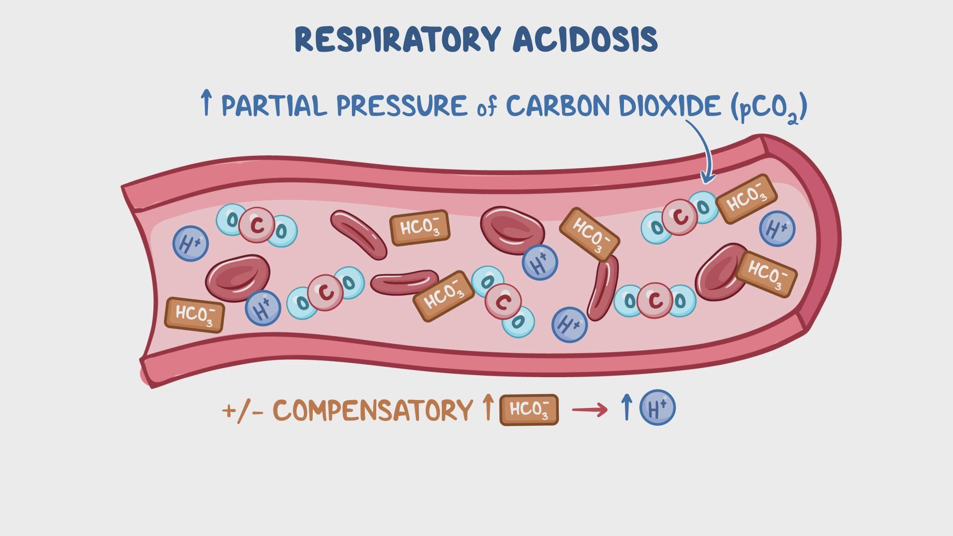 Video: Approach to respiratory acidosis: Clinical sciences