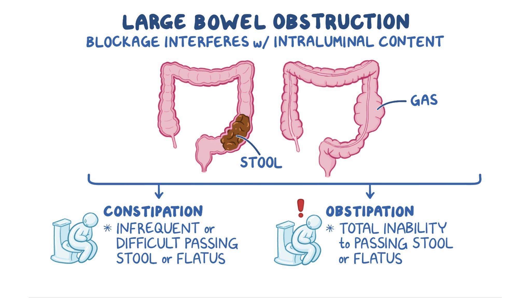 Video Large Bowel Obstruction Clinical Sciences Osmosis Video Large Bowel Obstruction Clinical Sciences Osmosis