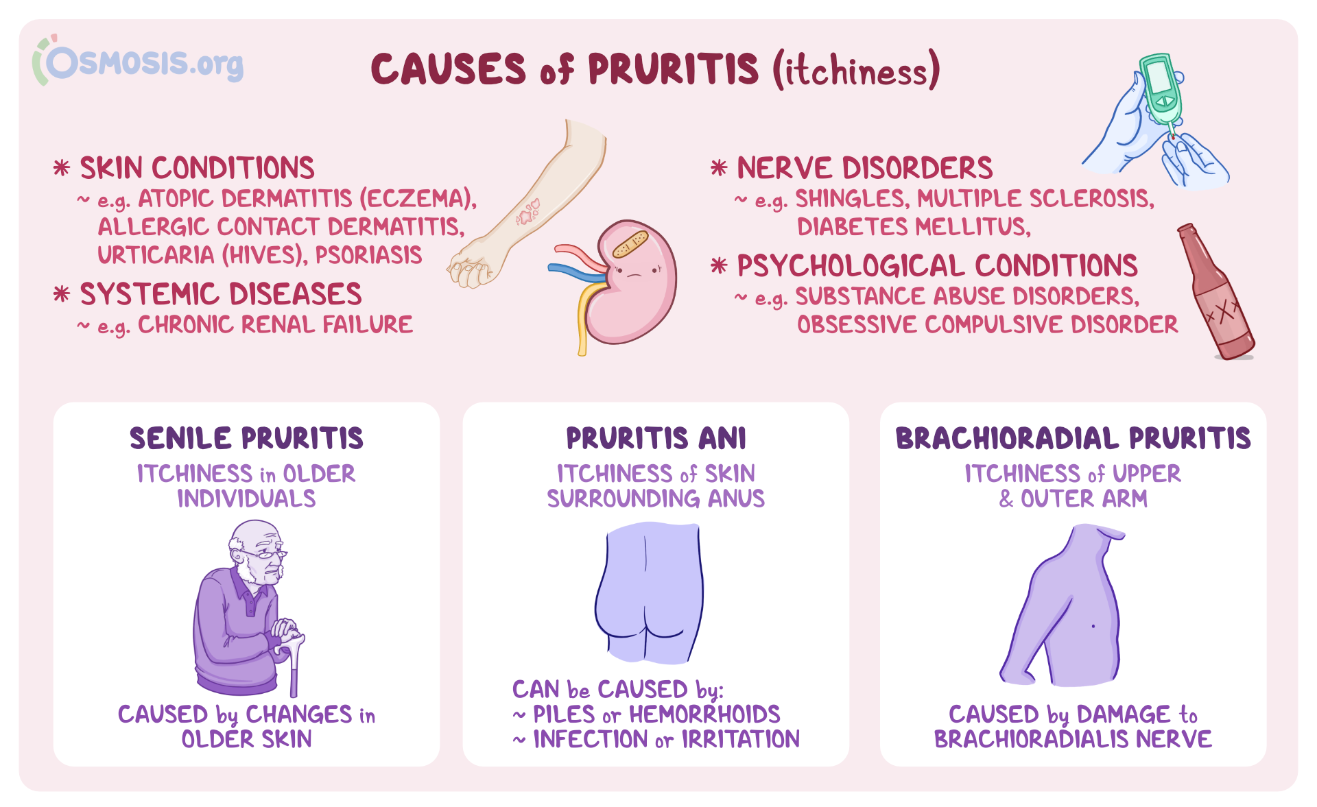 Pruritus What Is It Causes Types Treatment And More Osmosis Pruritus What Is It Causes Types Treatment And More Osmosis